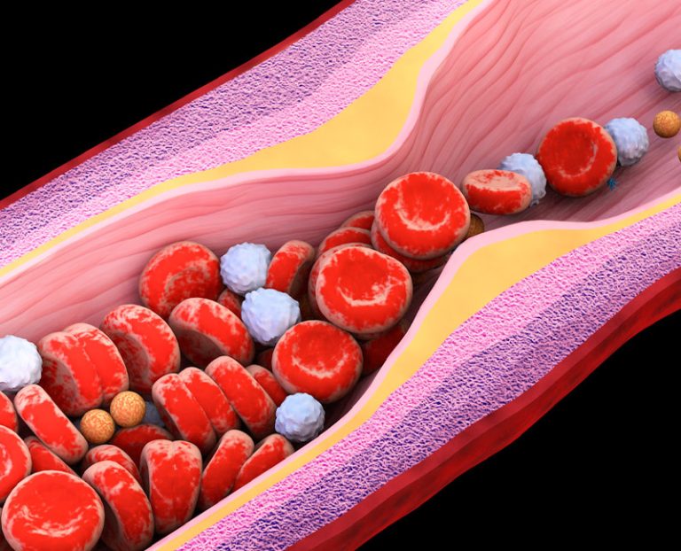 Cholesterol Control: Tips for a Heart-Healthy Life | Shore Physicians Group